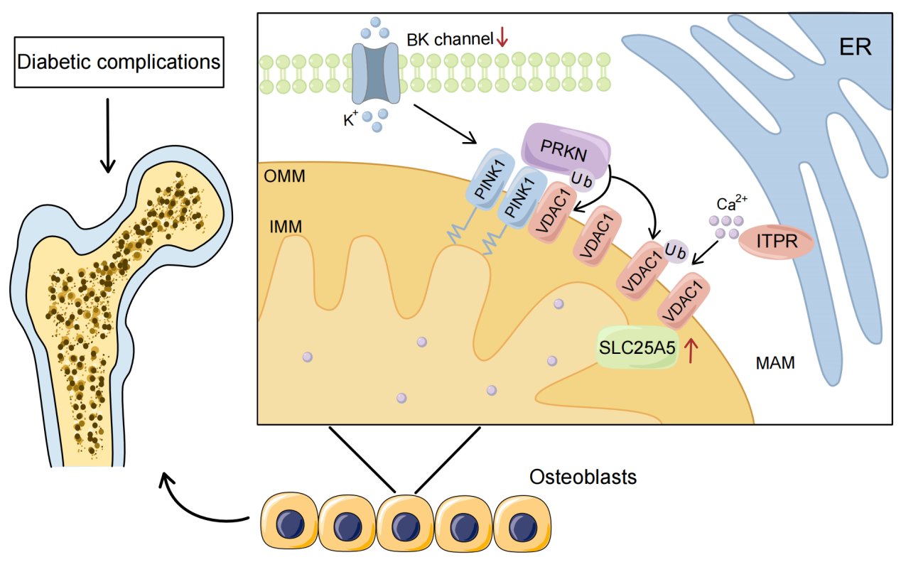 Autophagy｜我院张雪梅教授课题组报道了糖尿病骨损伤中调控线粒体自噬新机制
